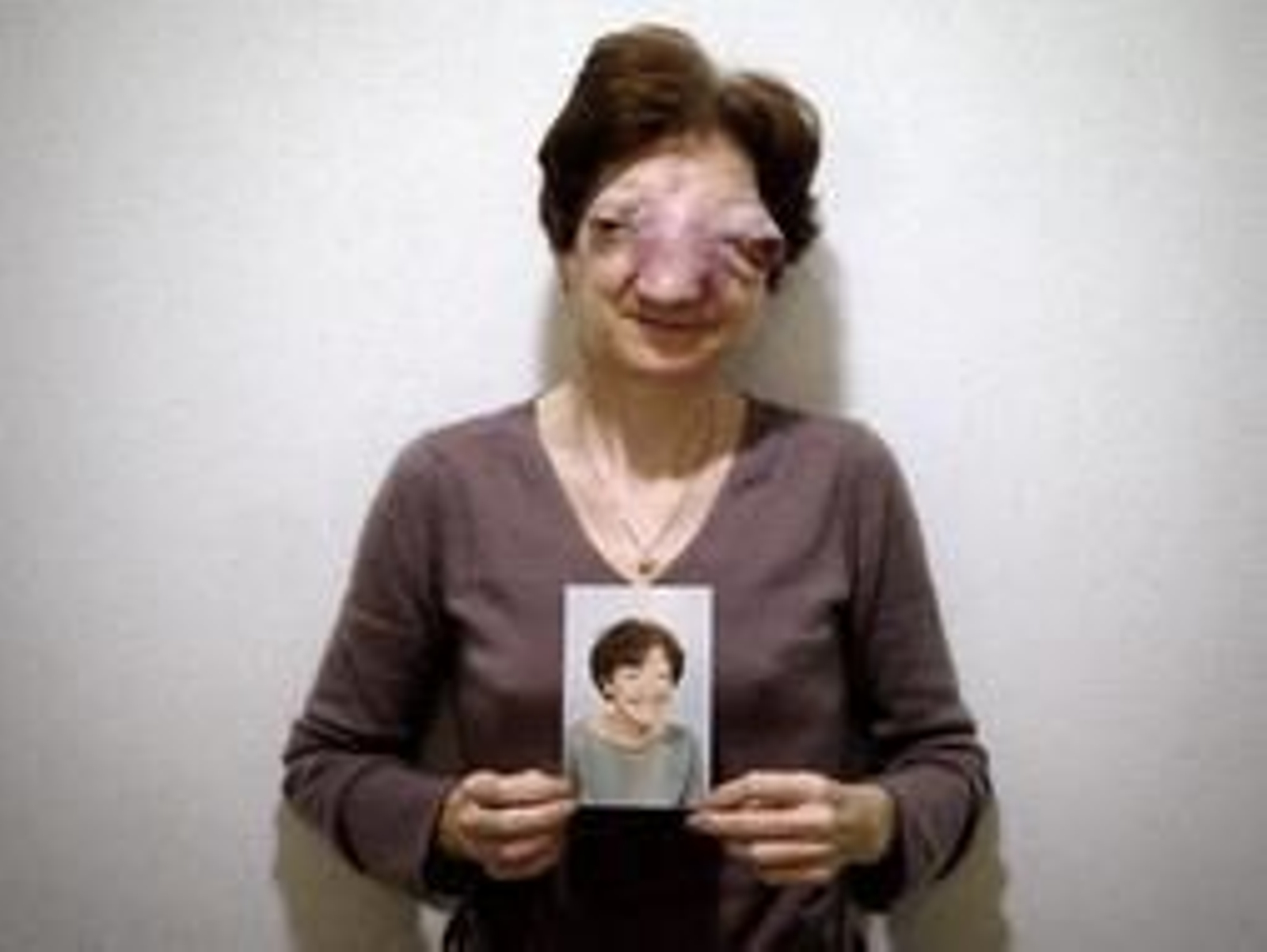 Chantal Sébire falleció por consumir una dosis mortal de barbitúricos