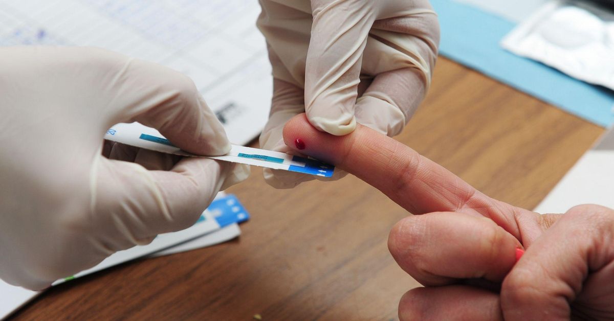 Qué es el VIH, cómo detectarlo y tratarlo